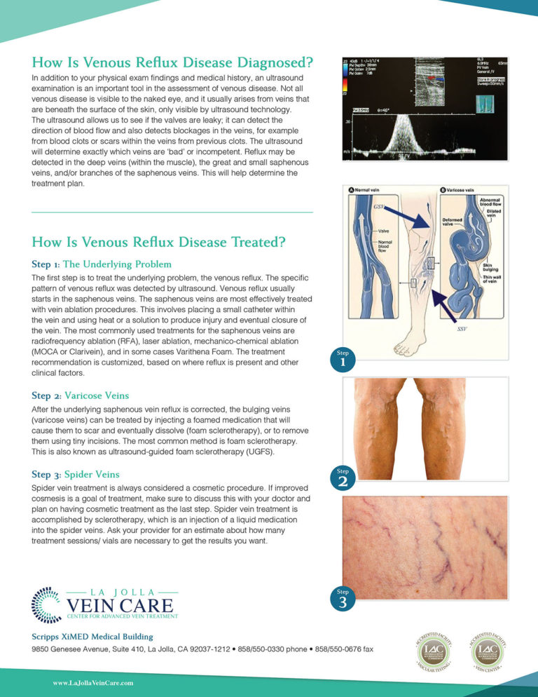 Patient Handouts Information on Vein & Vascular Treatments