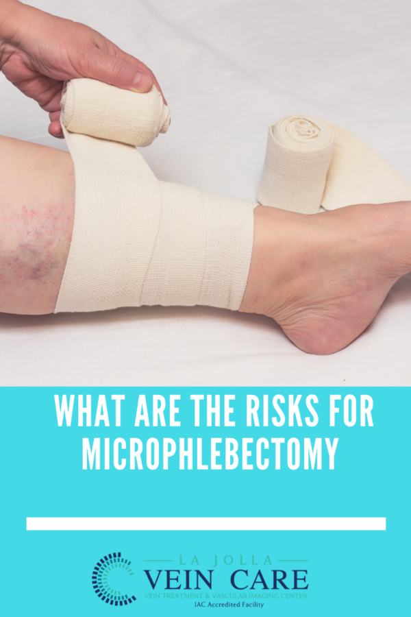 microphlebectomy