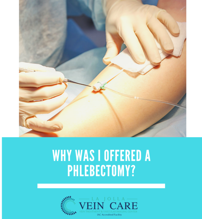 Phlebectomy