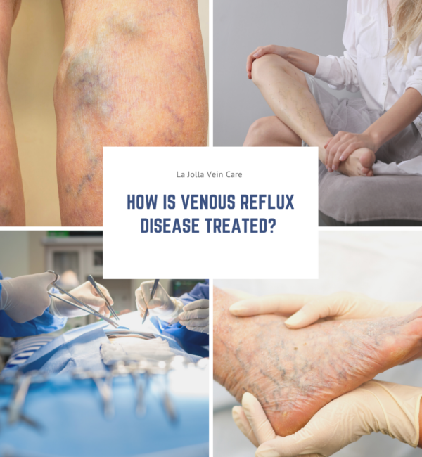 venous reflux disease