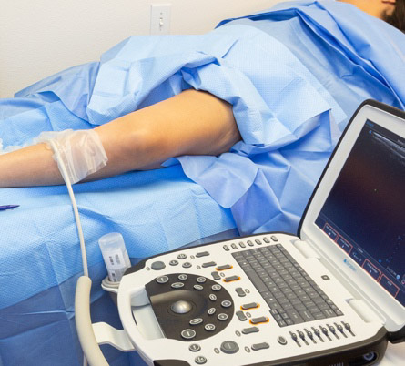 Vein & Vascular Treatment | Vein and Vascular Care Clinic | La Jolla, CA