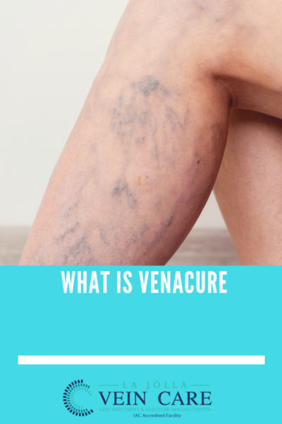 Vein & Vascular Treatment | Vein and Vascular Care Clinic | La Jolla, CA
