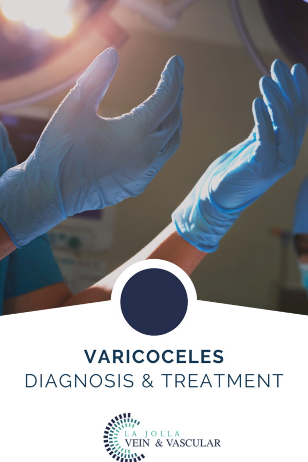 Varicocele Diagnosis and Treatments