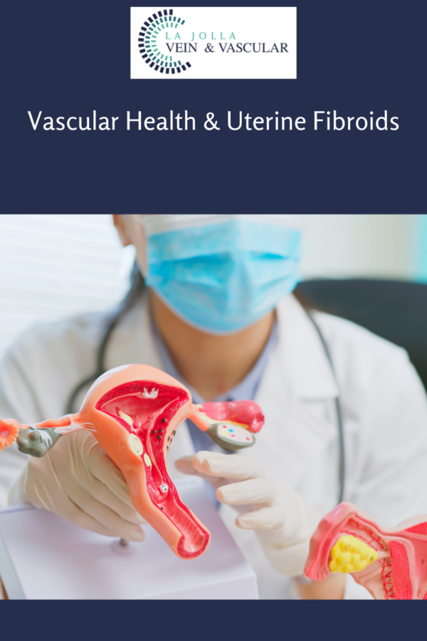 Vein & Vascular Treatment | Vein and Vascular Care Clinic | La Jolla, CA