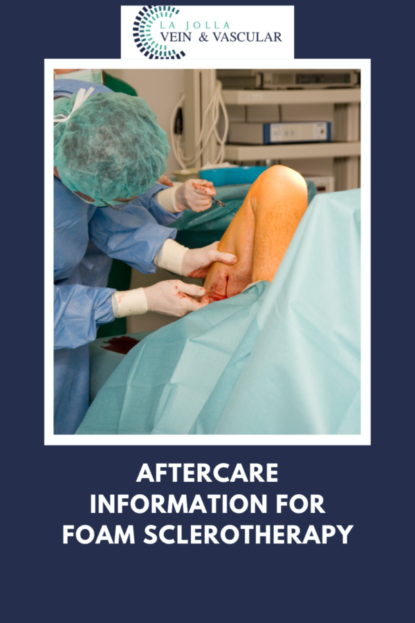 sclerotherapy
