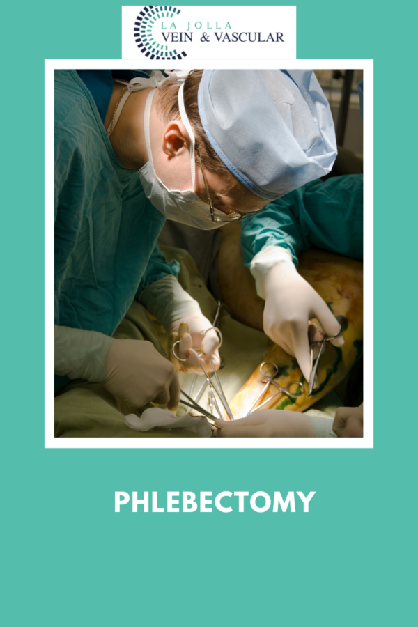 Phlebectomy
