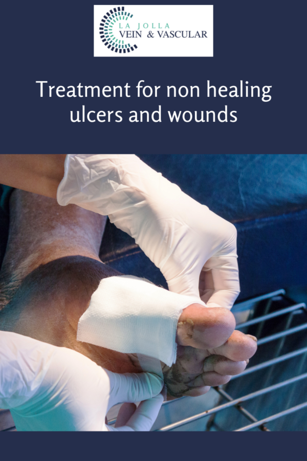 Ulcers and non healing wound care