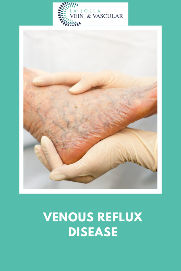 Venous