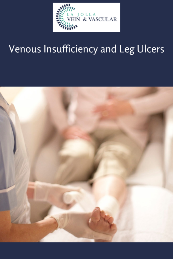 Chronic Venous Insufficiency and Leg Ulcers