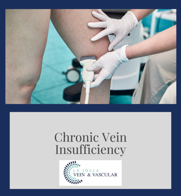 Chronic vein insufficiency