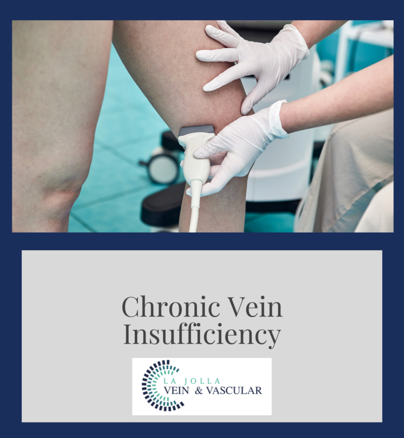 Chronic vein insufficiency