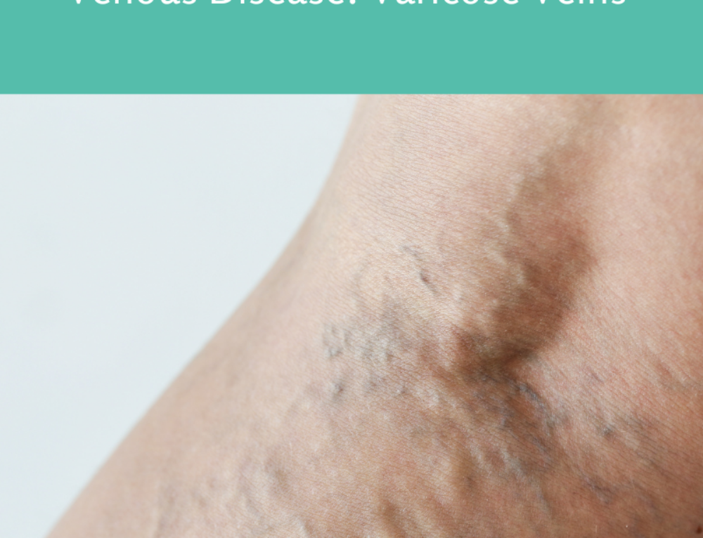 Oh My! My Vein is Bleeding, What Now?