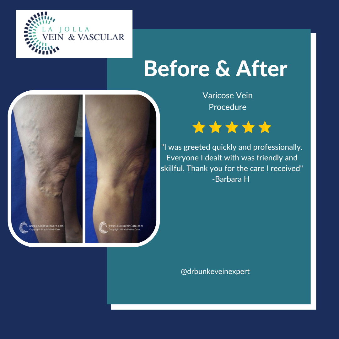 Vein & Vascular Treatment | Patient Testimonials