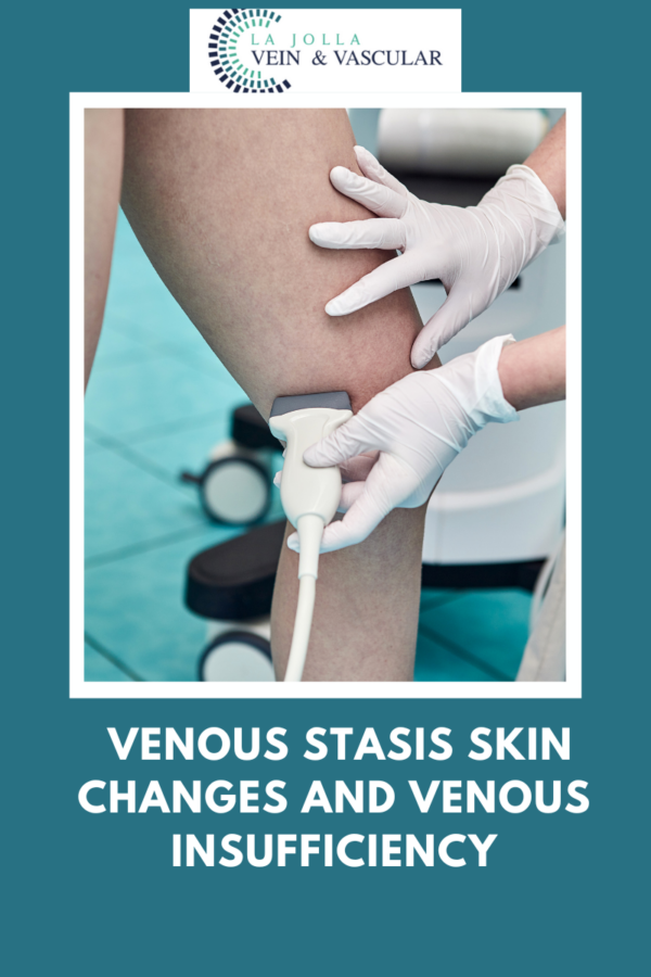 Venous Stasis Skin Changes