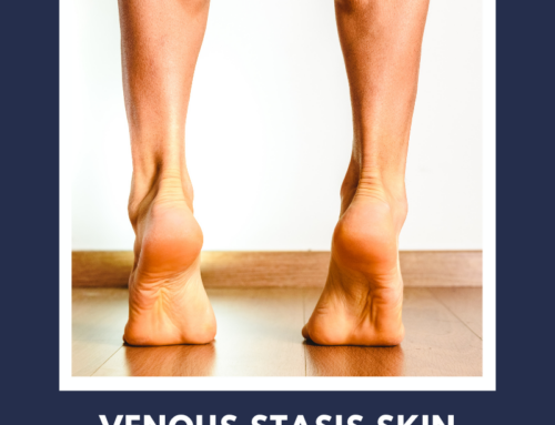 Vein & Vascular Treatment | Vein and Vascular Care Clinic | La Jolla, CA
