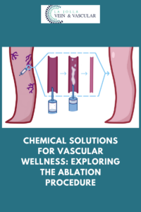 What is Vein Mapping? Unlocking Its Role in Vascular Health