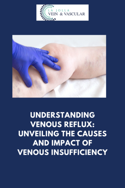 Venous Reflux Causes & Symptoms: What You Need to Know