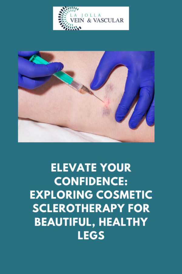 Cosmetic Sclerotherapy Treatment for Beautiful, Healthy Legs