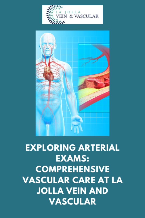 Arterial Exams | Best Vein & Vascular Diagnostics in SD