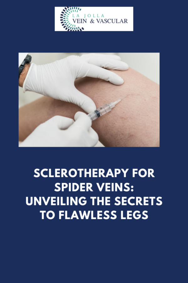 Unveiling the Secrets to Flawless Legs | Sclerotherapy Procedure