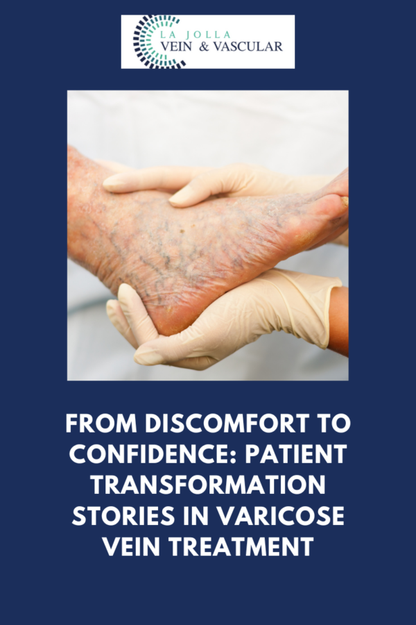 How Do You Diagnose a DVT? Ultrasound Scan Diagnosis