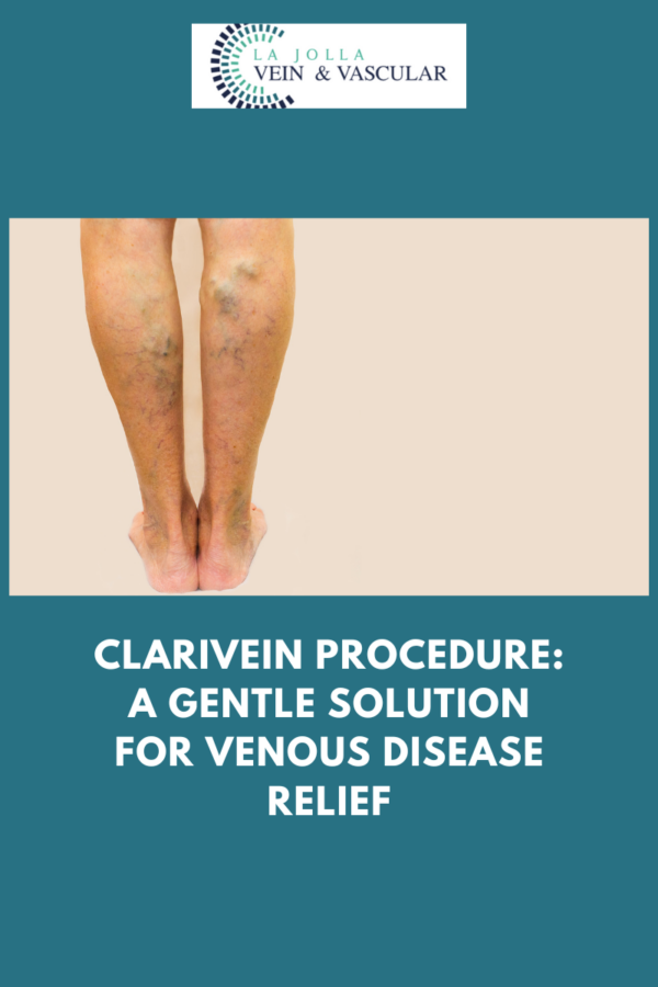 ClariVein Procedure: Solution for Venous Disease Relief