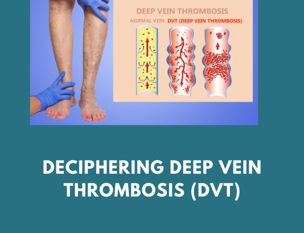 The Great Saphenous Vein (GSV) | Short Saphenous Vein (SSV) | La Jolla