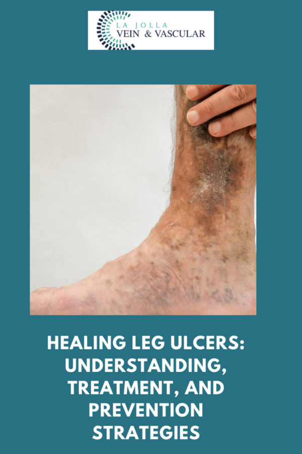 Leg Ulcers Treatment | Vein and Vascular Care Clinic