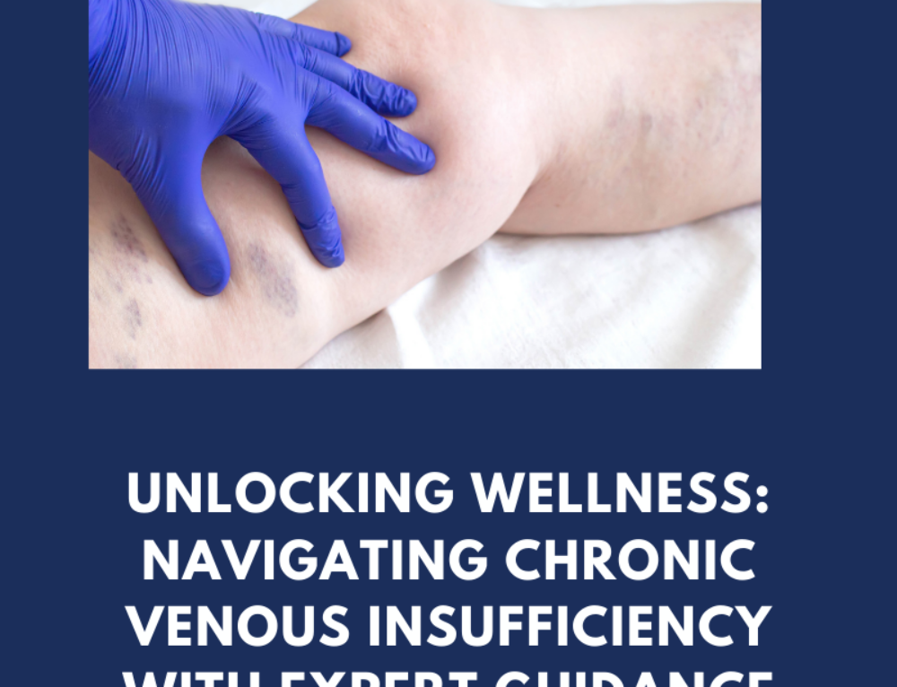 The Great Saphenous Vein (GSV) | Short Saphenous Vein (SSV) | La Jolla