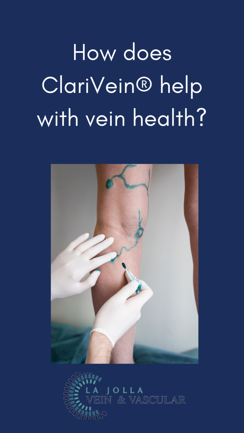 ClariVein® Procedure Treatment | Vein & Vascular Care Clinic