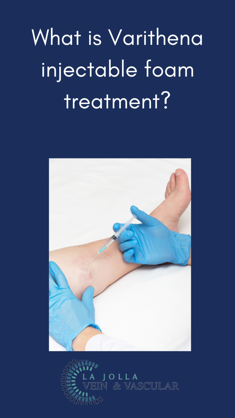 Varithena Injectable Foam Treatment — and What is it?