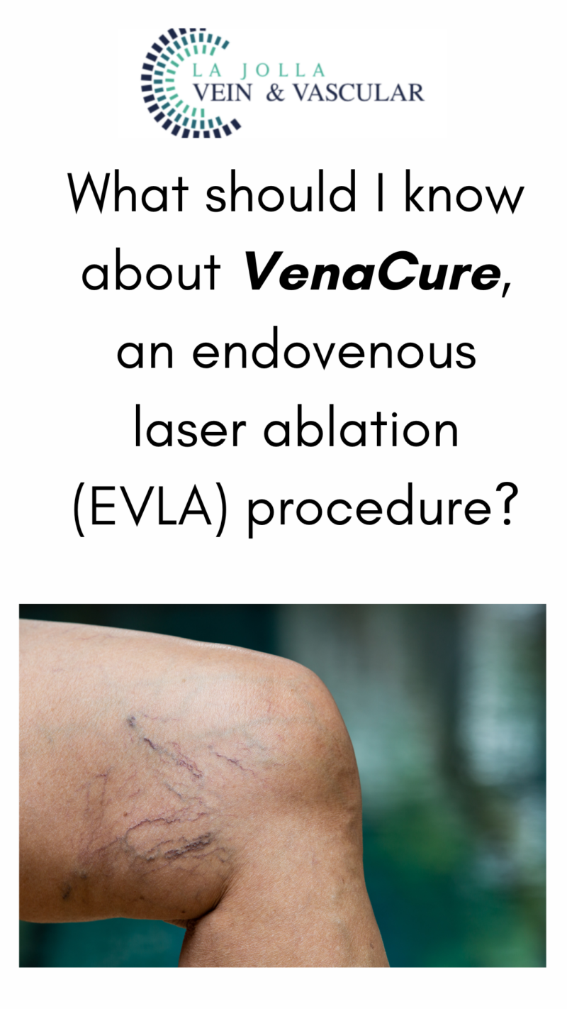 What Should I Know About VenaCure, Endovenous Laser Ablation